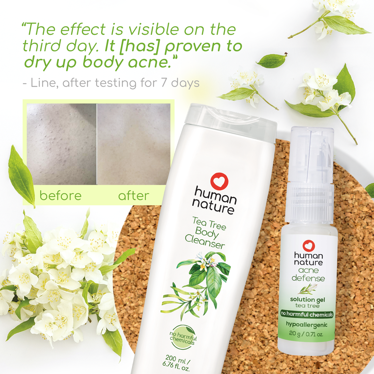 Human Nature Tea Tree Body Acne Gel 50g – Urban Essentials Philippines